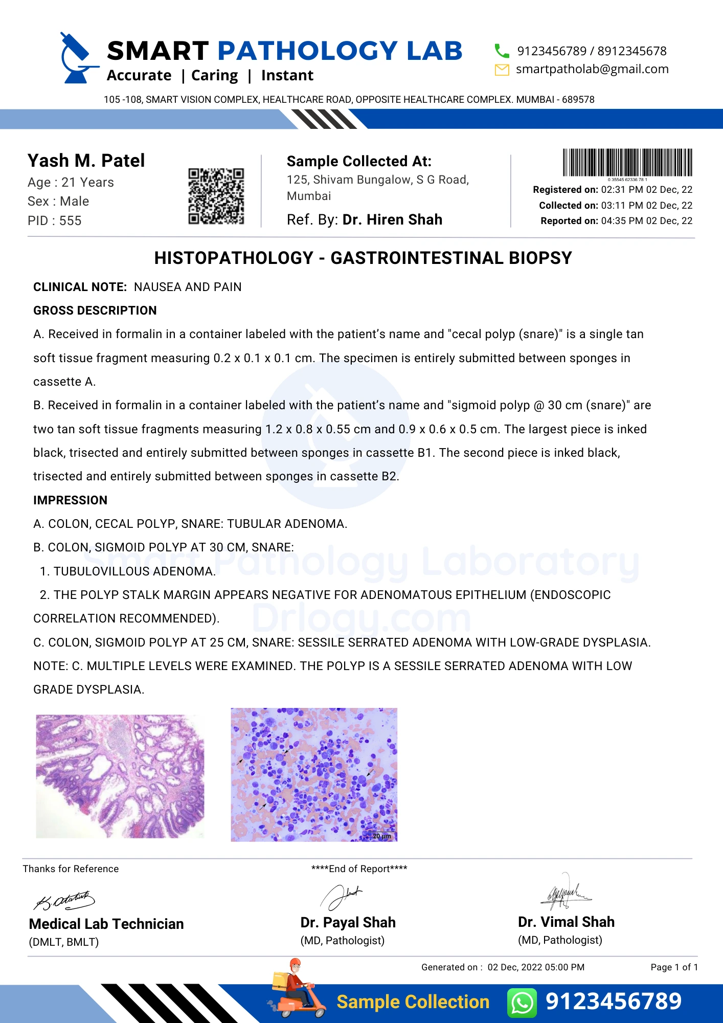 Histopathology Report Pathology Report From D c R hysterectomy